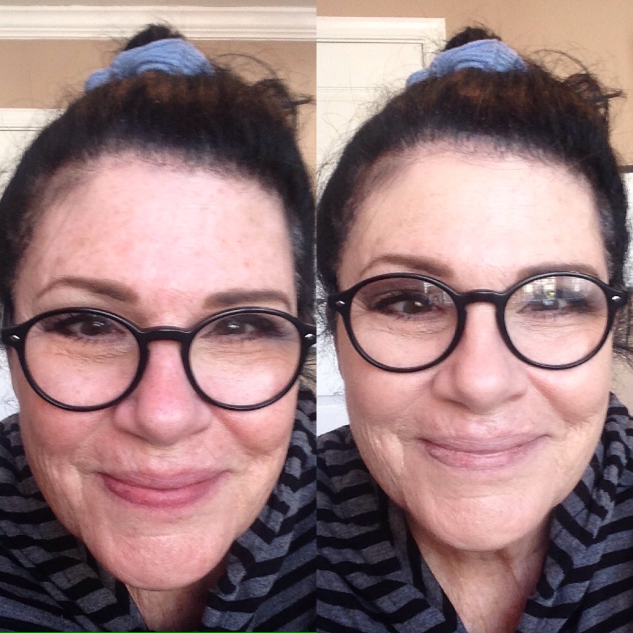 Before and after | Atypical 60