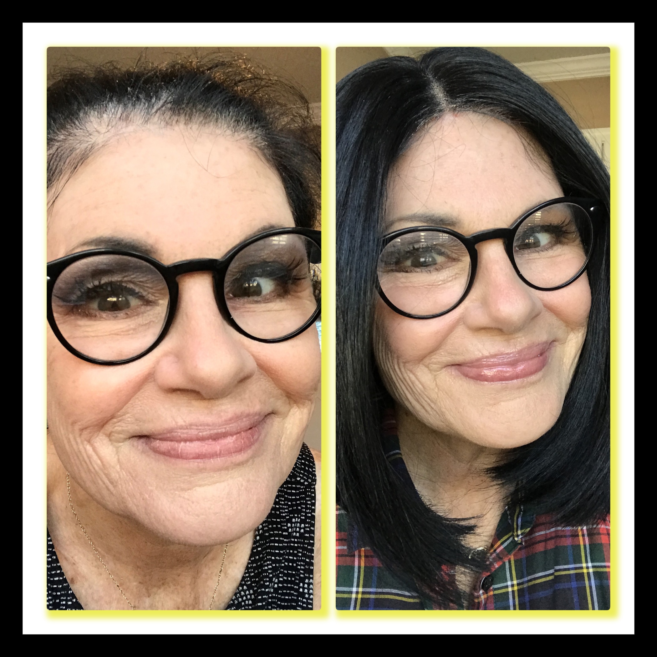 after before hair after with hair | Atypical 60